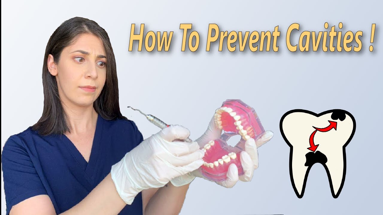 What causes cavities? | How to prevent cavities! - YouTube