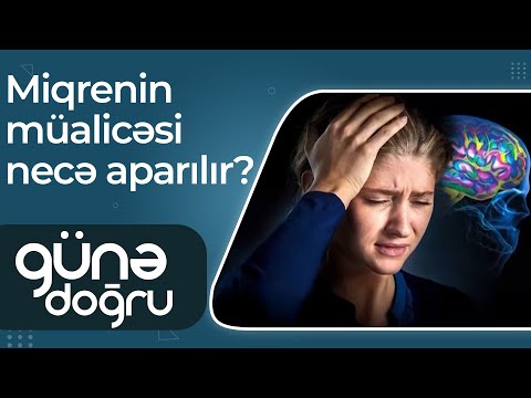 Miqren xəstəliyi: Miqrenin müalicəsi necə aparılır? – Günə Doğru