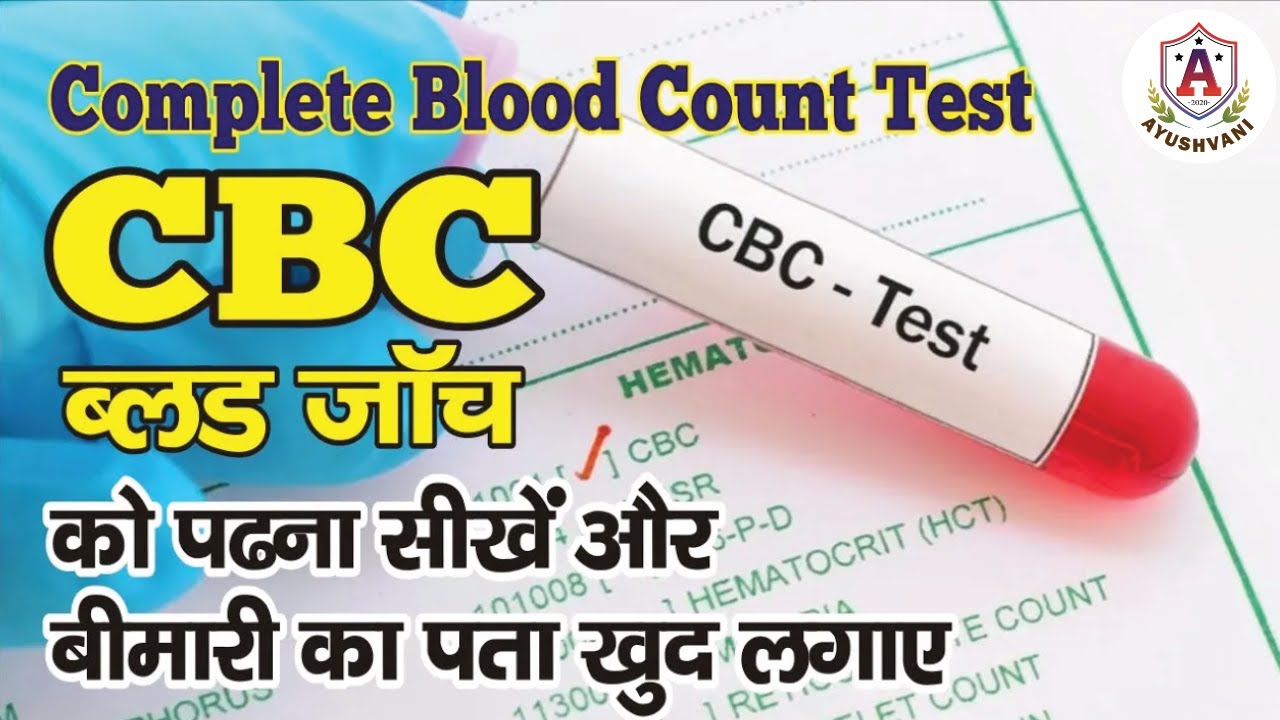 CBC Blood Test In Hindi Complete cbc-blood-test-in-hindi-complete