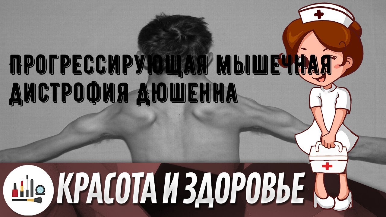Прогрессирующая мышечная дистрофия Дюшенна Youtube