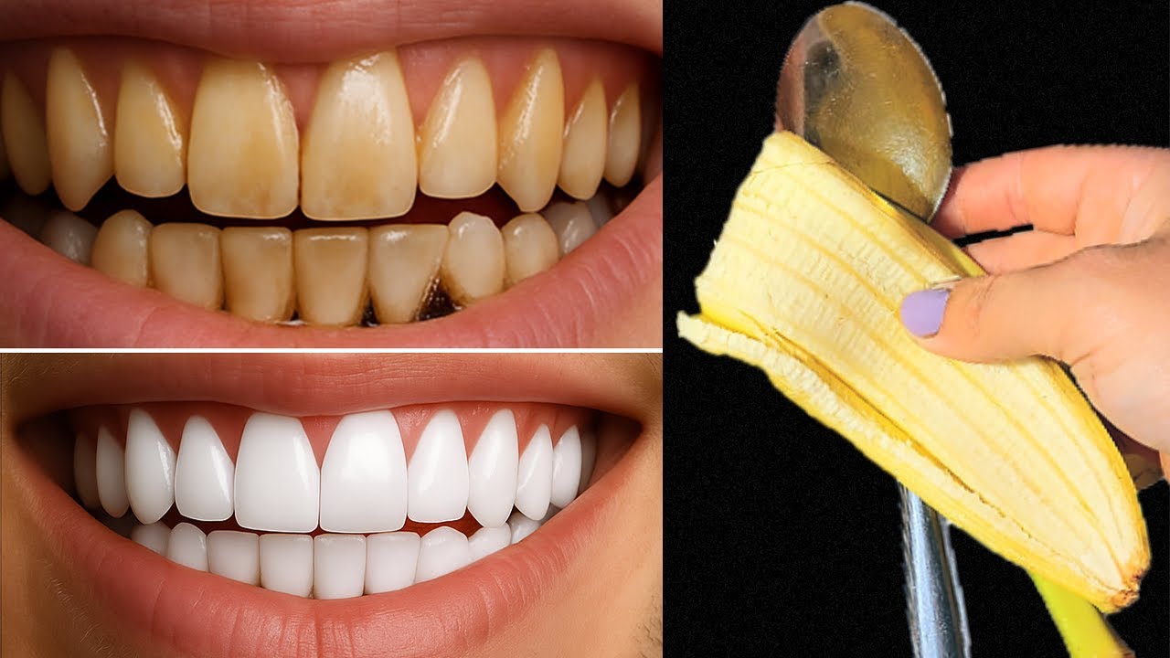 Fast teeth whitening in 2 minutes! 🌟 A pearly white smile guaranteed! 😁 ...