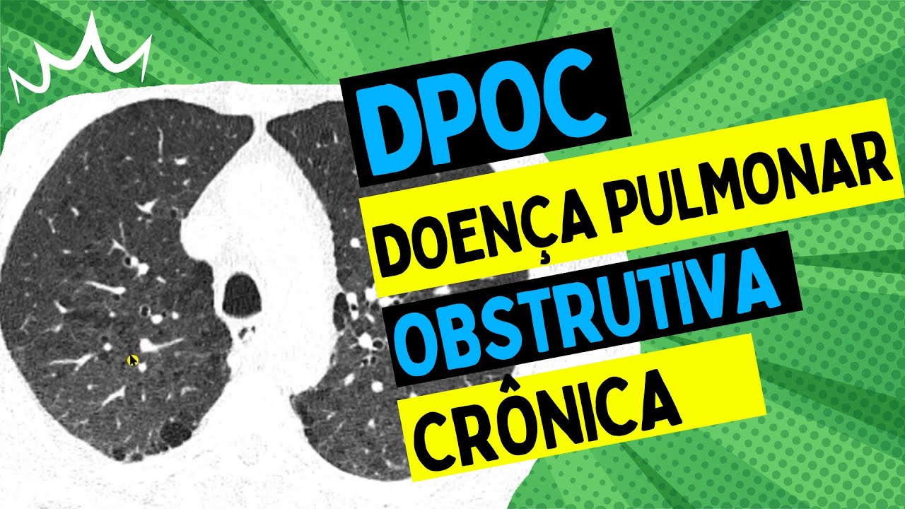 DPOC - DOENÇA PULMONAR OBSTRUTIVA CRÔNICA - YouTube