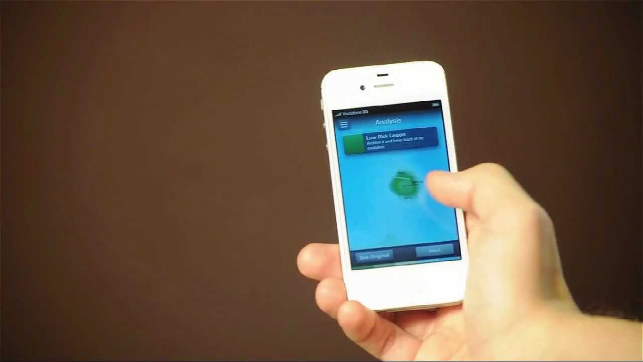 SkinVision Website Background - YouTube