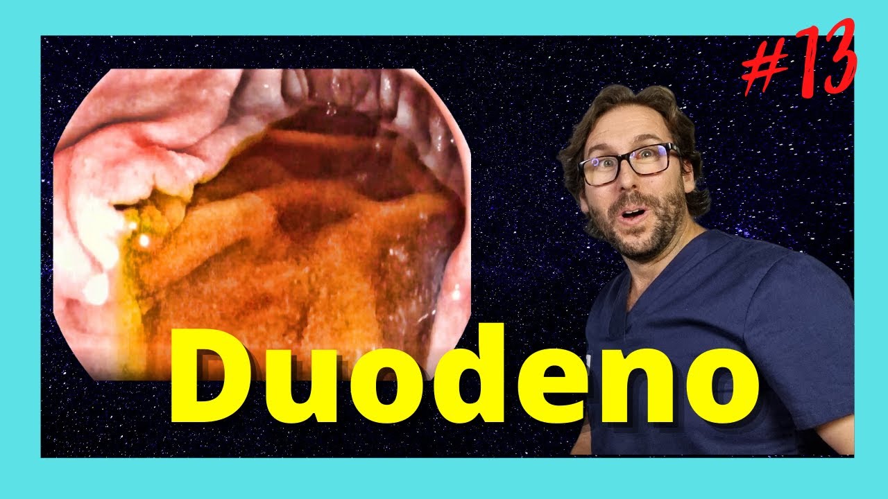 🧐 ENDOSCOPIA en DUODENO te resumo lo + TOP 💥. CURSO ENDOSCOPIA ...