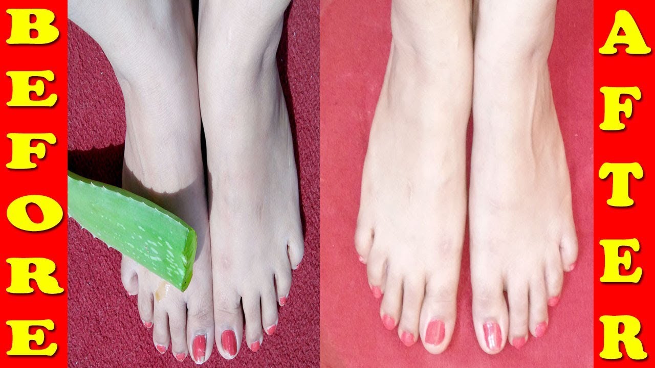 Feet Whitening Pedicure At Home 100% effective/ Remove Sun Tan from ...