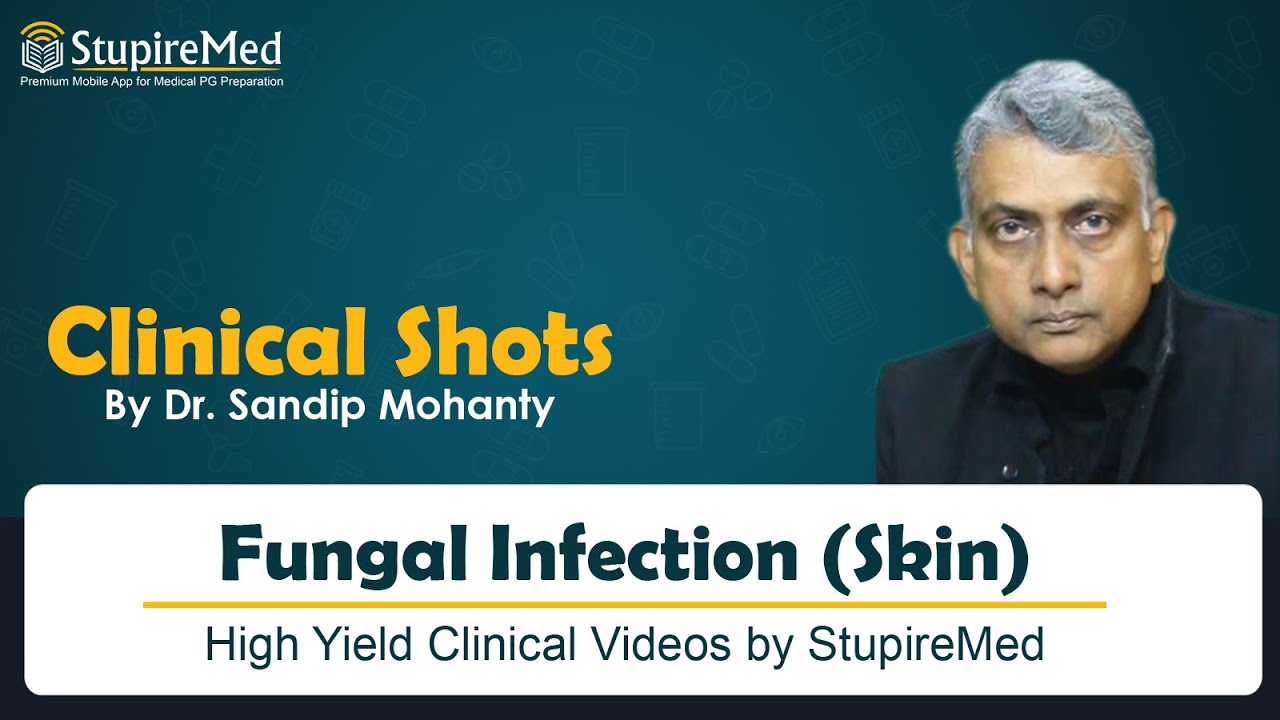 Clinical Shots I Dermatology I Fungal Infection Skin I Dr. Sandip Mohanty - YouTube