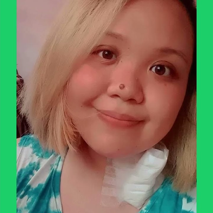 CRONIC KIDNEY DISEASE STAGE 4 YouTube cronic-kidney-disease-stage-4-youtube