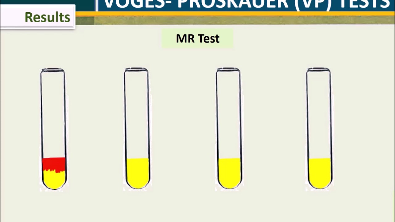 IMViC Test- Principle, Result Chart, Examples, Uses, 57% OFF IMViC Test- Principle, Result Chart, Examples, Uses, 57% OFF