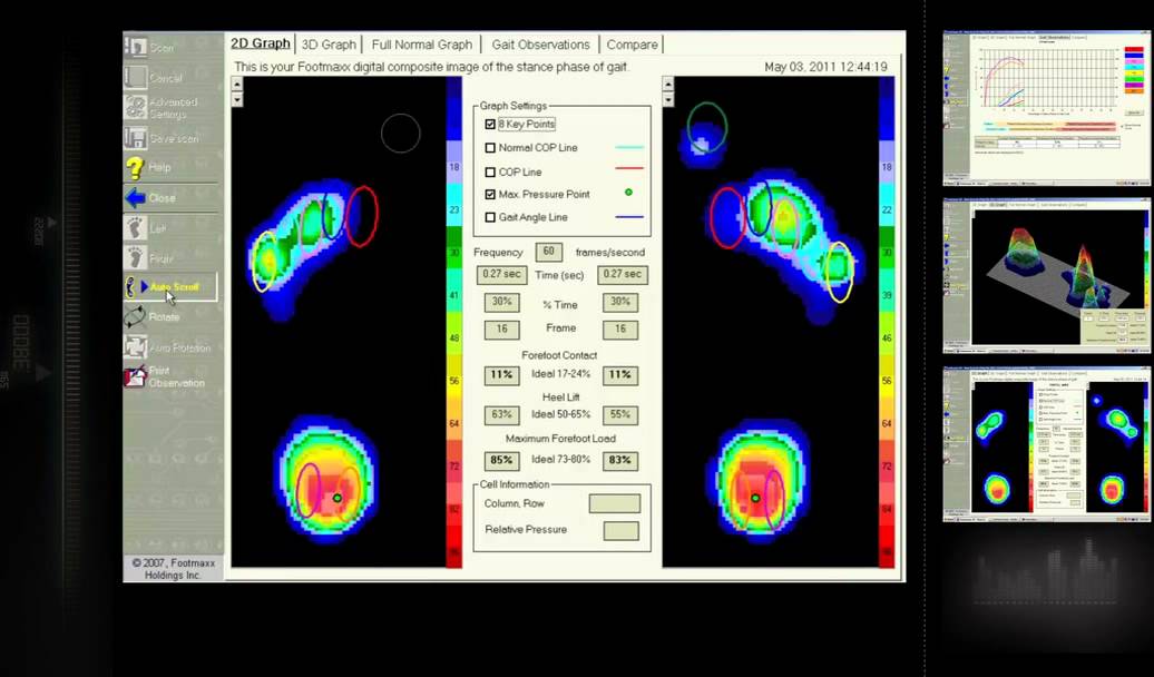 What Does Your Walk Say About You? (Footmaxx Metascan) - YouTube