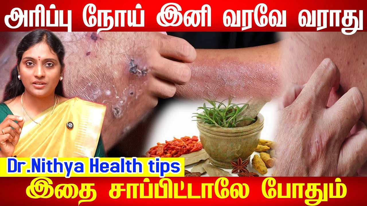 அரிப்பு நோய் நீங்க எளிய தீர்வு Itchy Skin Treatment skin disease ...