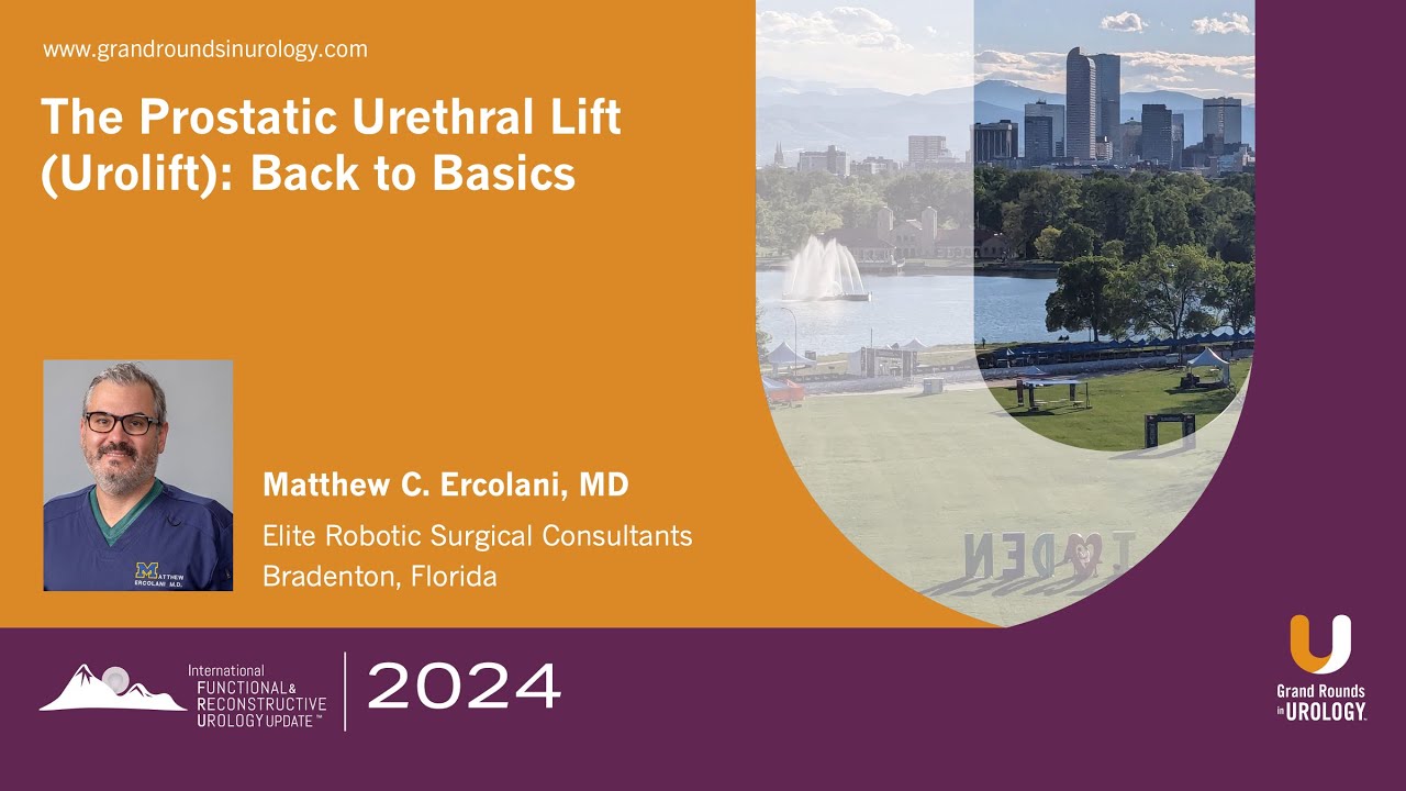 The Prostatic Urethral Lift (Urolift): Back to Basics by Matthew C ...