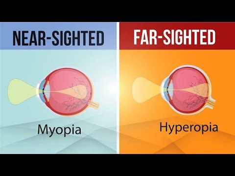 Eye defects | दृष्टि दोष | Myopia and hypermetropia in hindi | Class 10 ...