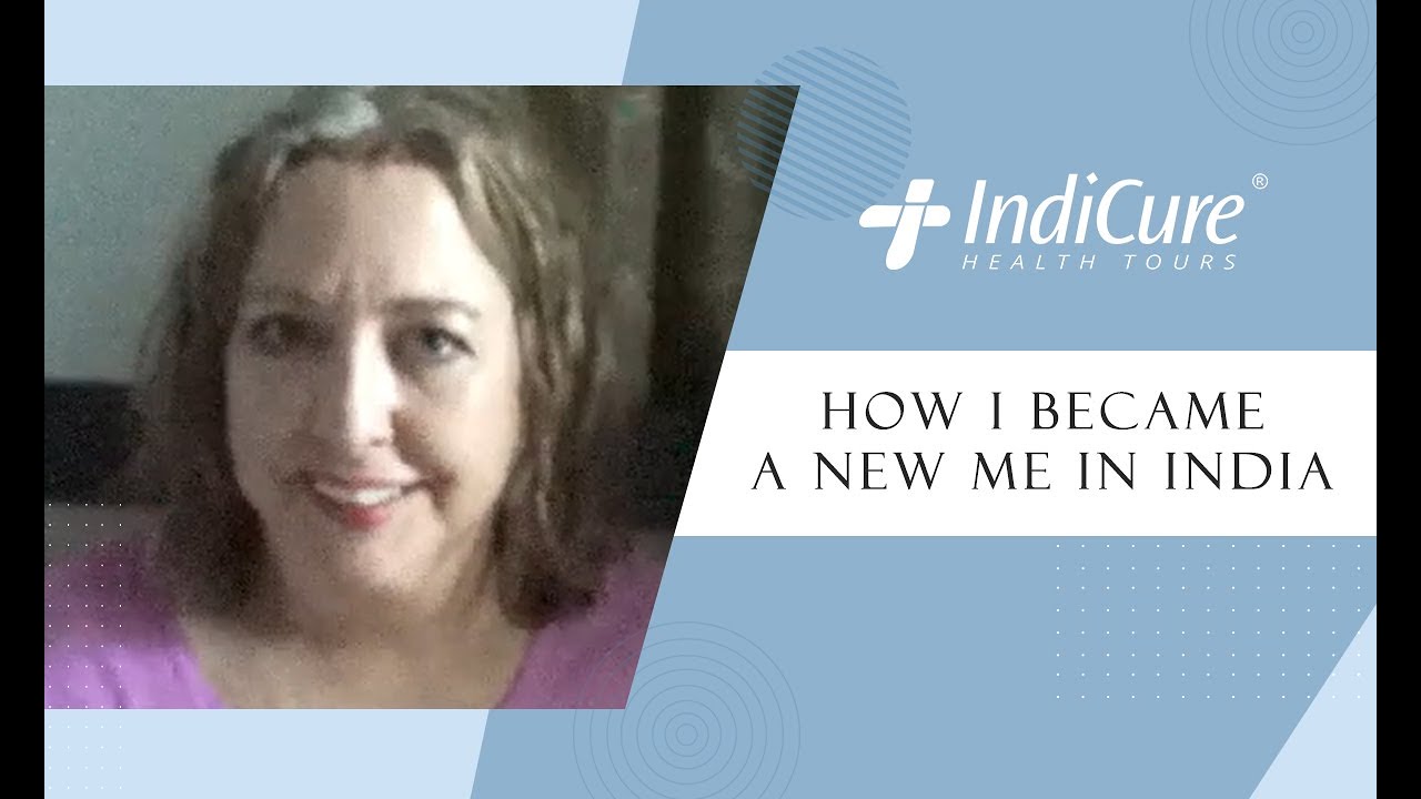 Face Lift Surgery in India Testimonial: How I Became a New Me in India ...