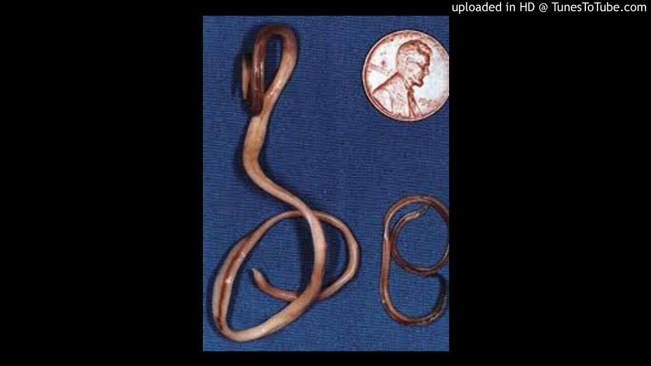 Round worm is communicable/infectious disease. - YouTube