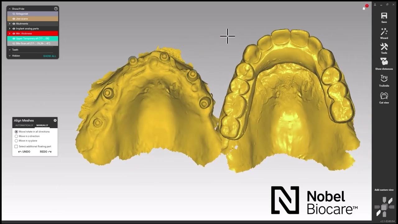 How to design your NobelProcera® full arch cases using iCam and exocad™ - YouTube