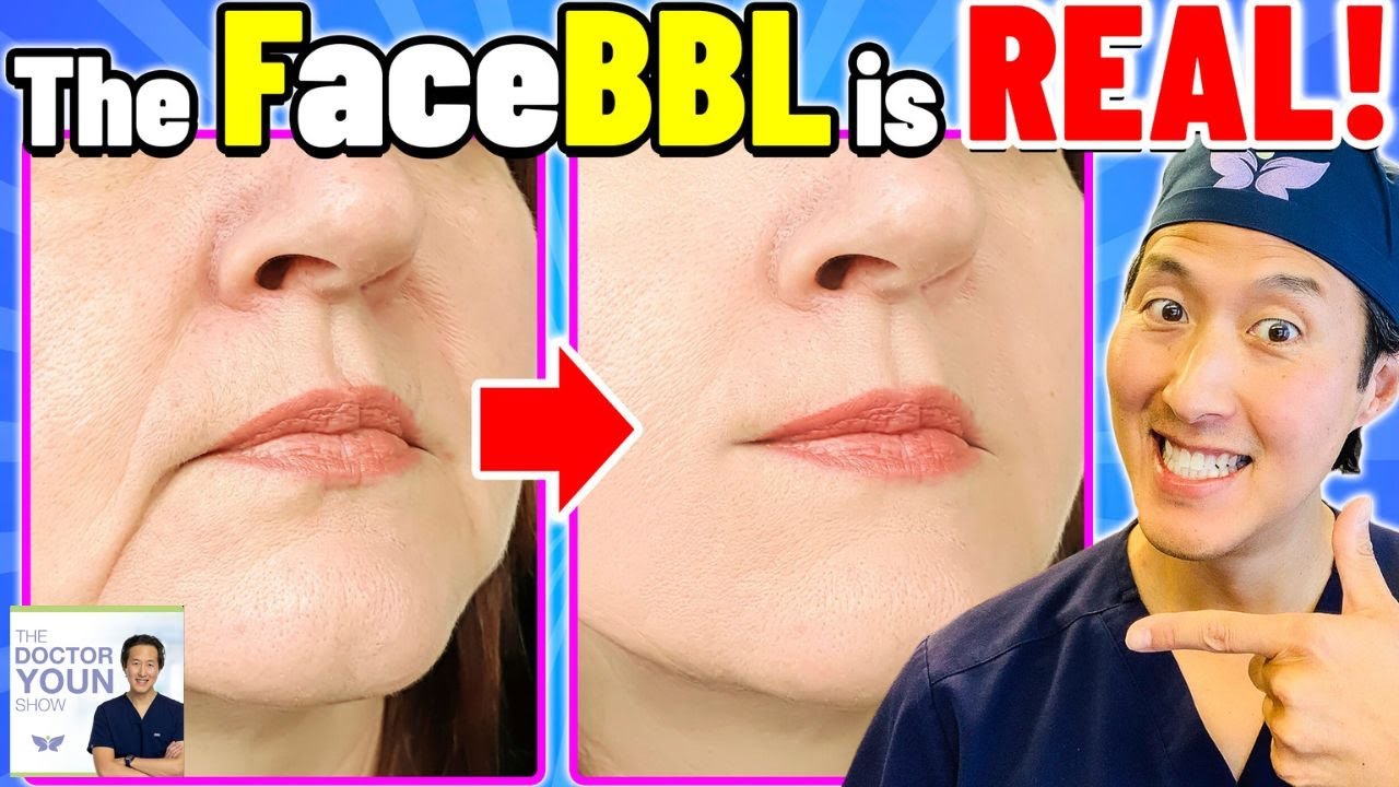 Hot Topics in Cosmetic Medicine: Dr. Youn’s Rosacea, Face BBL, Internal ...