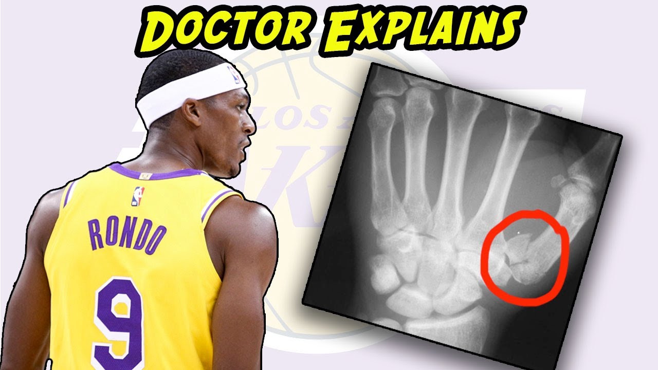 Lakers Guard Rajon Rondo Breaks His Thumb - Doctor Explains the Injury ...