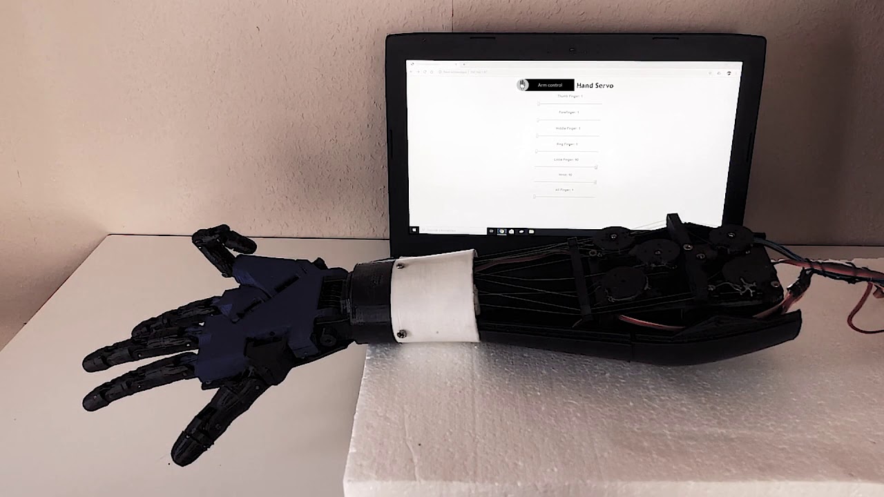 Designing and manufacturing a 3D printed robot arm implant remote ...