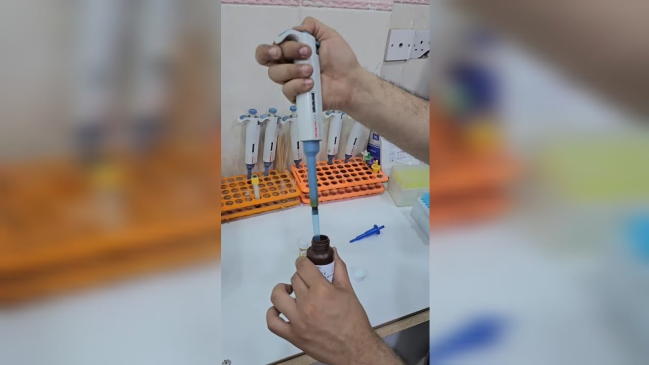 تحليل ابو صفار (البيليروبين في الدم) TSB Test (jaundice) - YouTube