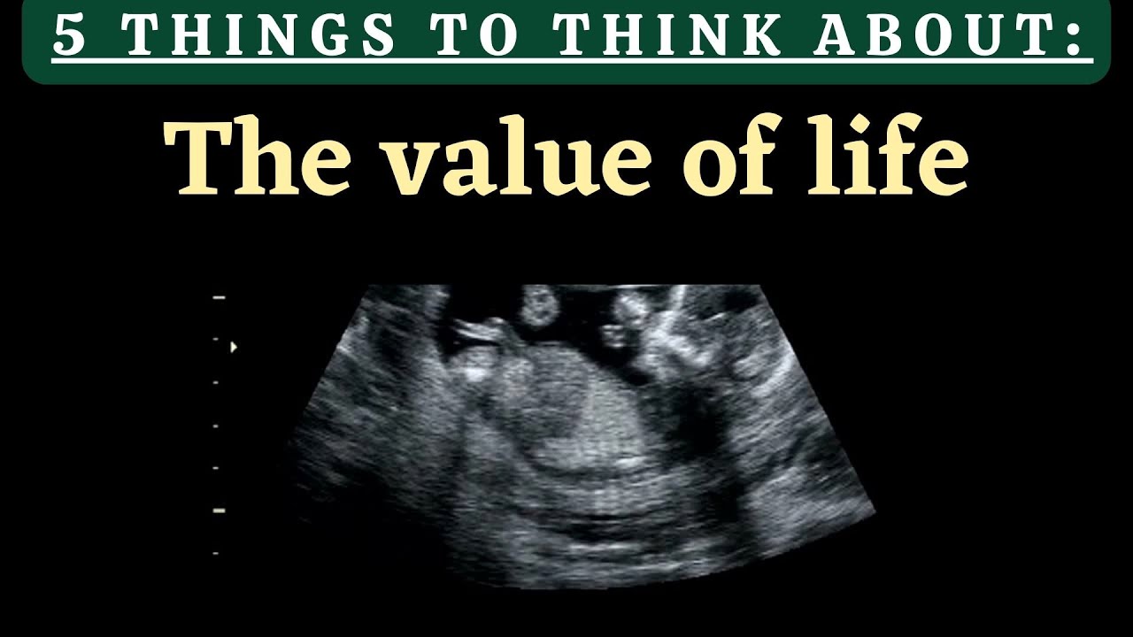 The Value of Life: 5 Things to Think About an Unborn Baby #unborn #baby ...