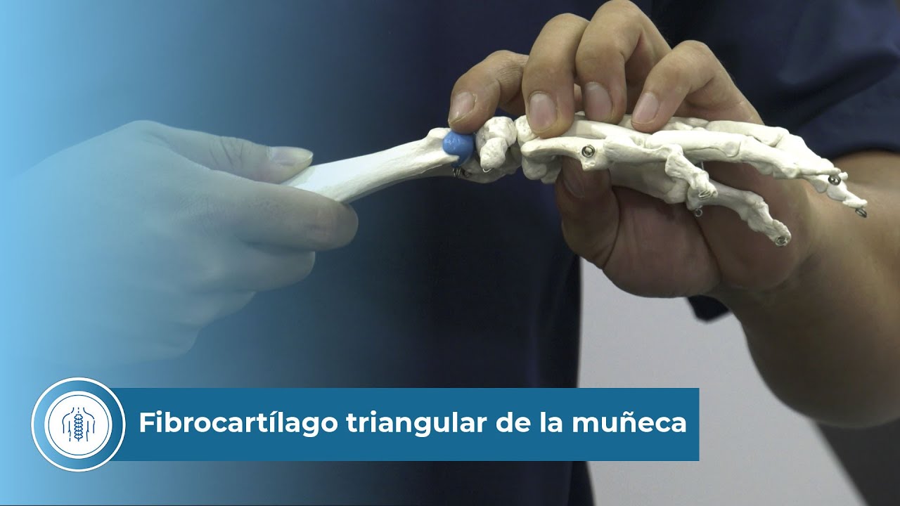 Fibrocartílago triangular de la muñeca - YouTube