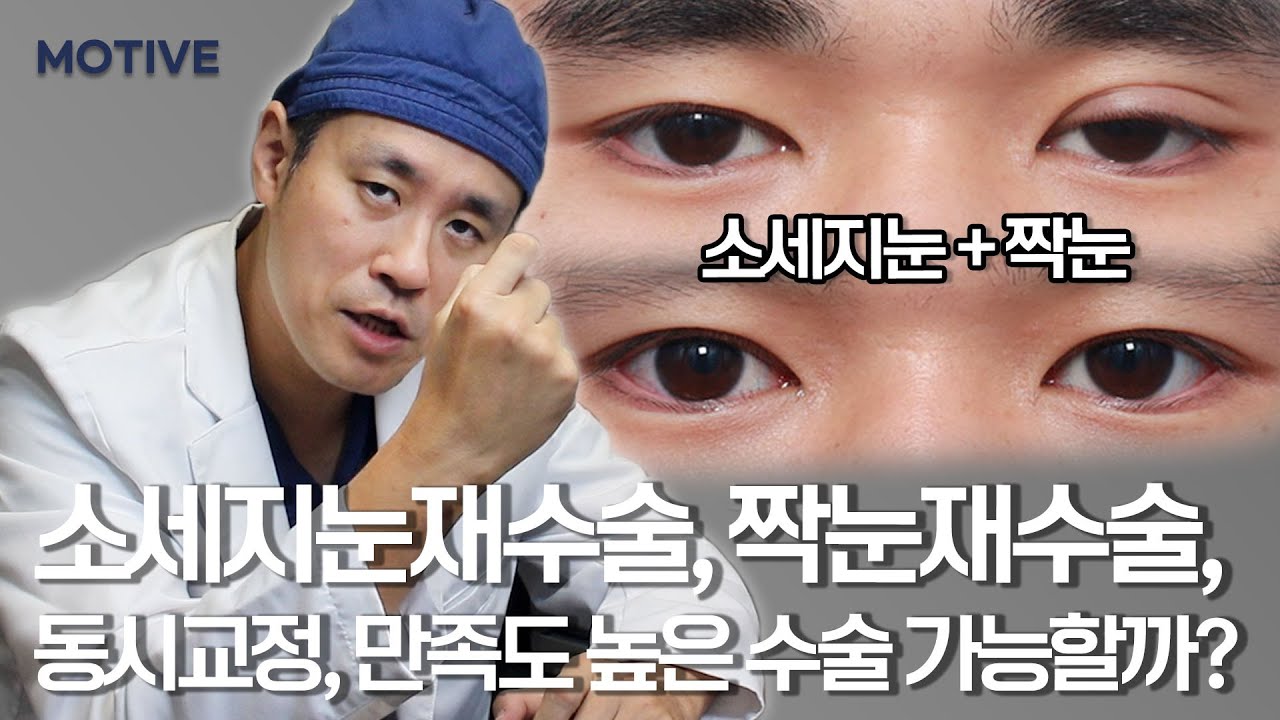 소세지눈재수술 짝눈재수술 동시 교정 만족도 높은 수술 가능할까요 눈재수술 Youtube
