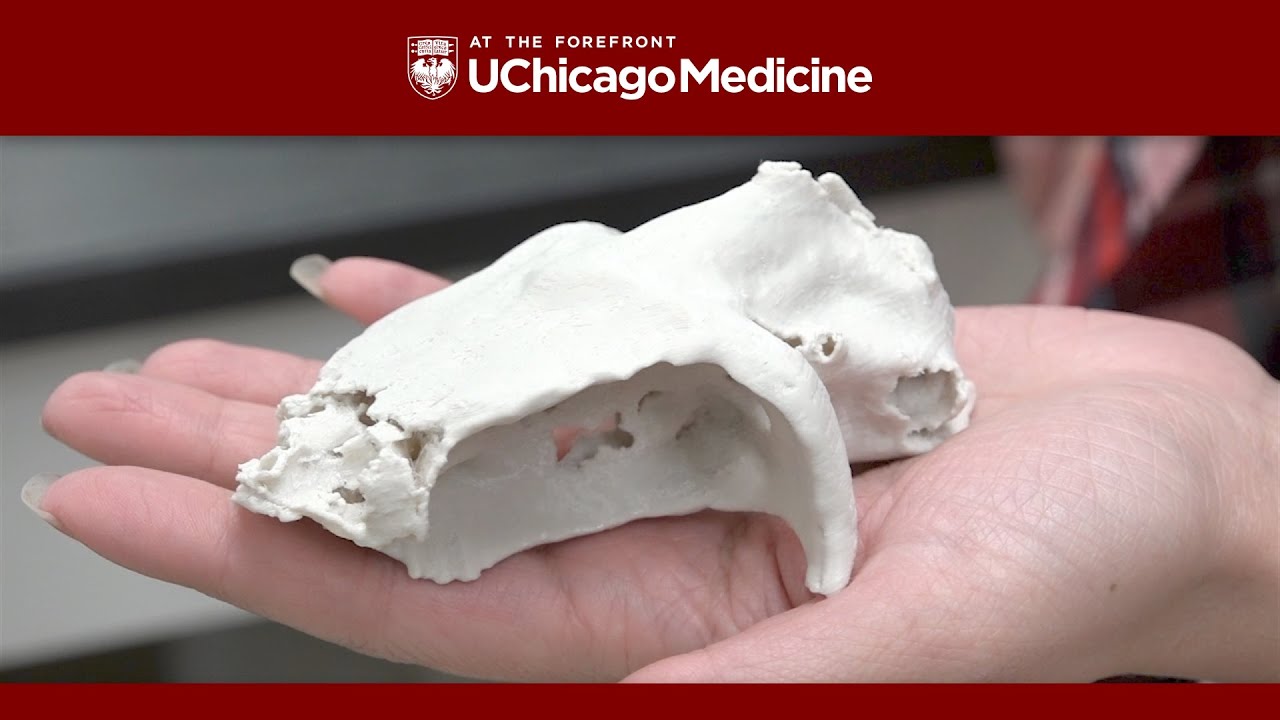 280 million-year-old fossil reveals origins of chimaeras - YouTube