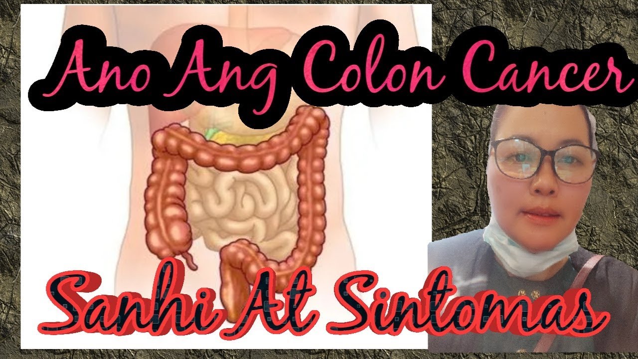 PART 1: ANO ANG COLON CANCER ? / ANO ANG MGA SANHI AT SINTOMAS /Simply ...