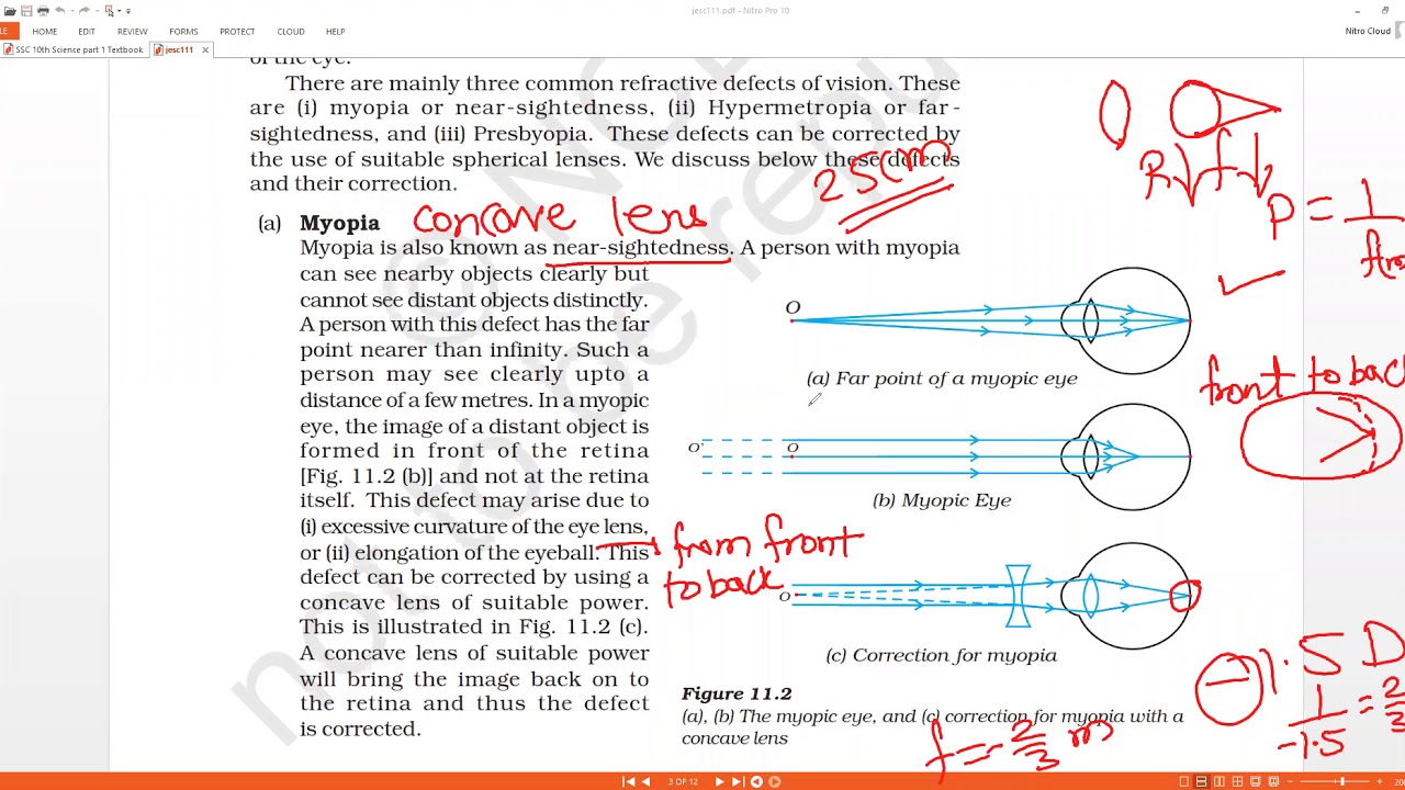 Class 10 Science - Defects of Human Eye. - YouTube