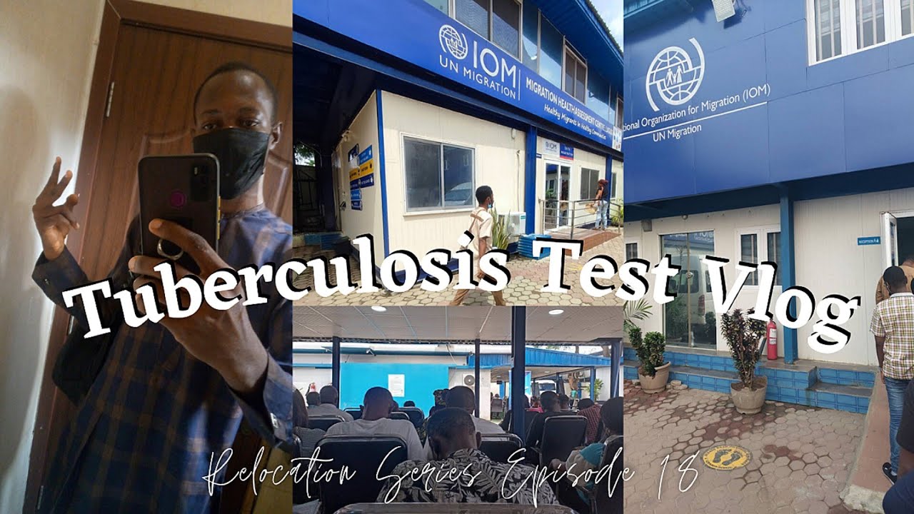 My IOM Tuberculosis Test Experience for UK Skilled Worker Visa | VLOG ...