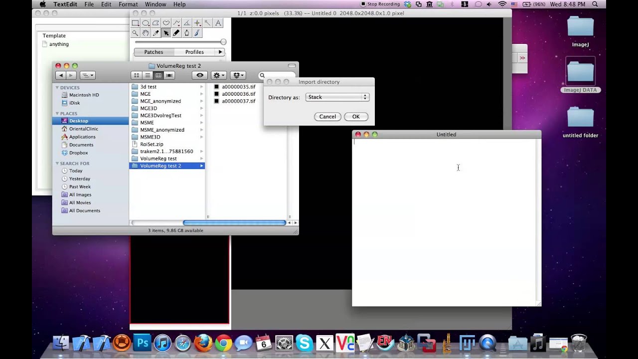 BII ImageJ 익히기 - 06.Registration, Fiji - YouTube