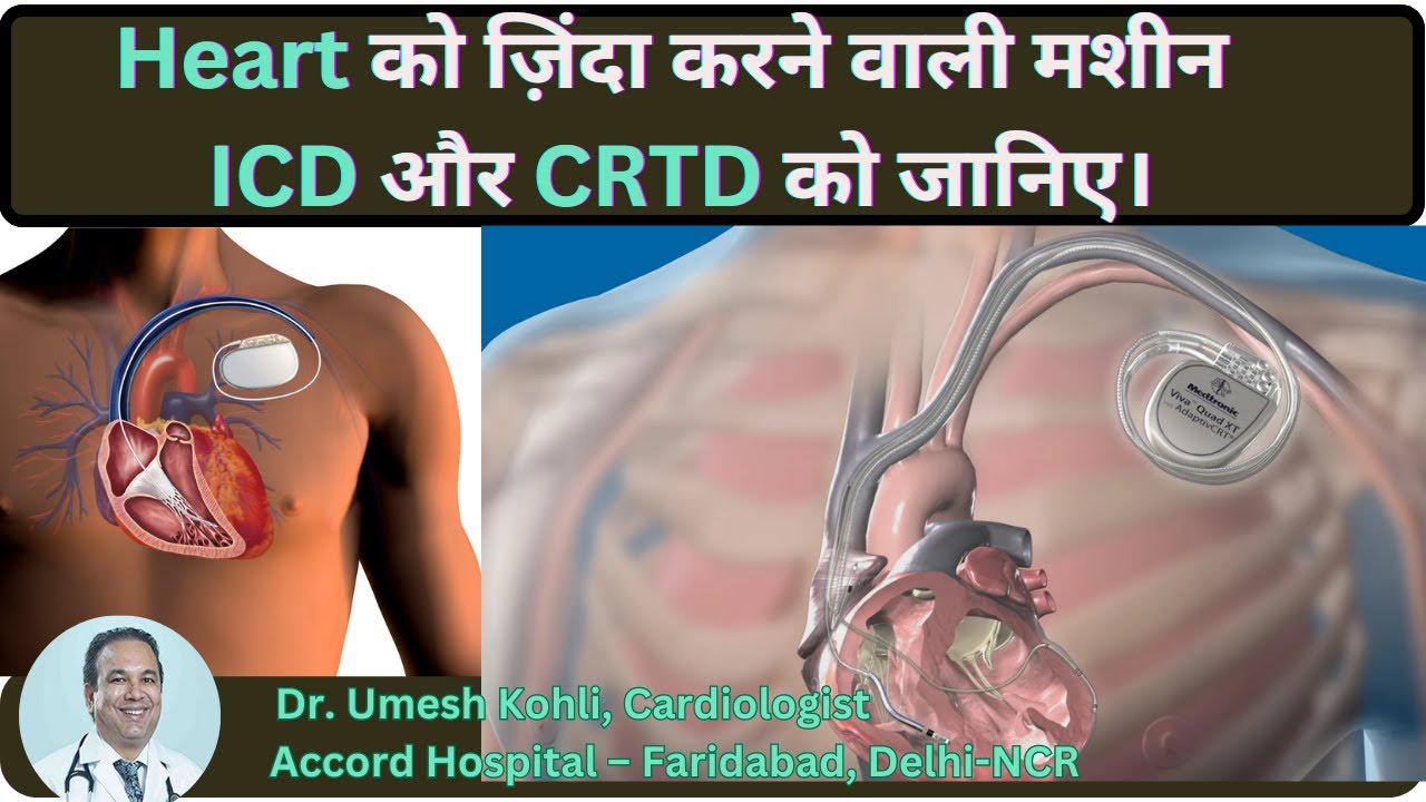 Heart को ज़िंदा करने वाली मशीन ICD और CRTD को जानिए | Healthy Talks with Shafiq Khan - YouTube