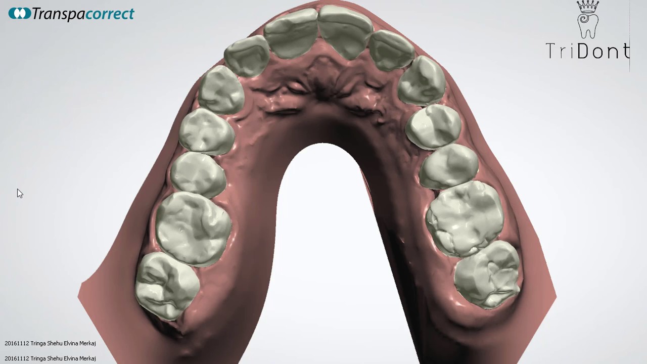 Pac E. M. TriDont Klinike Dentare - YouTube
