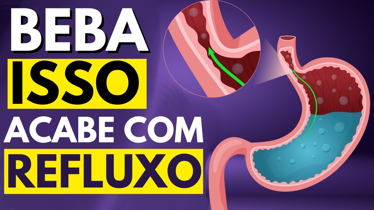 Melhores Bebidas Para Parar O Refluxo Ácido - YouTube