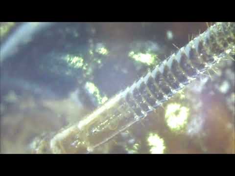 Why Does Cockroaches Have Antennae