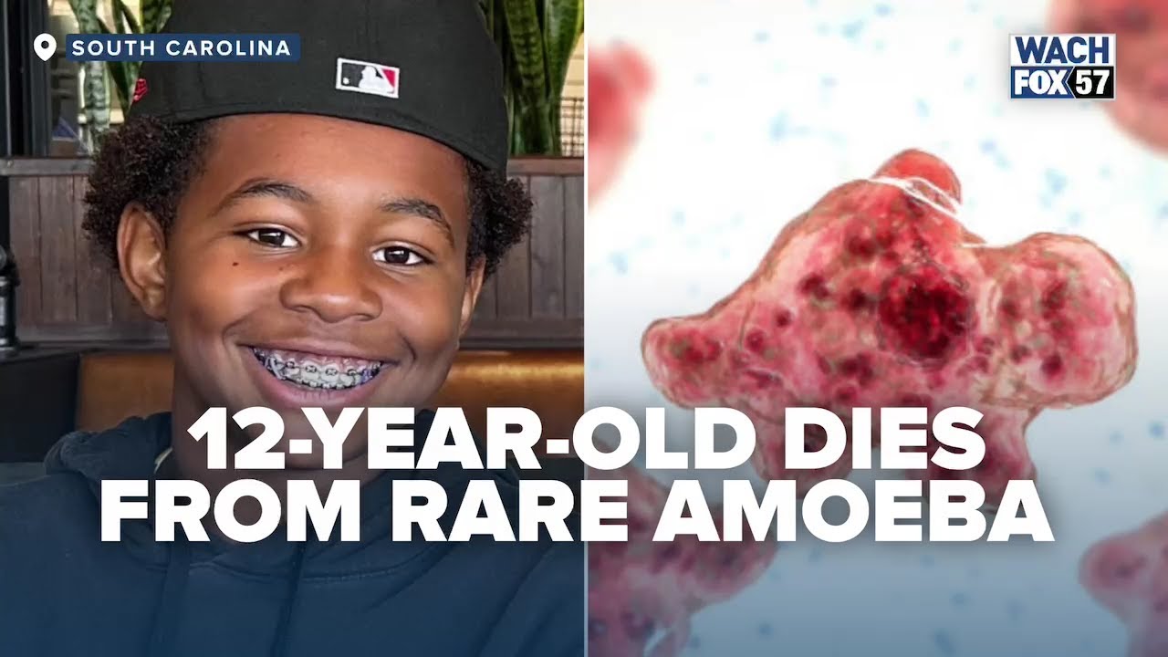 No Warnings, No Testing: How deadly brain-eating amoeba took 12-year ...