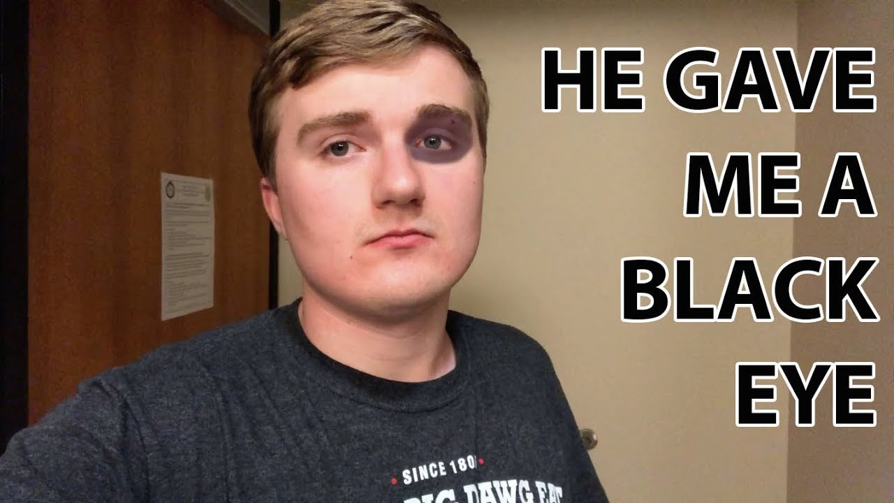I GOT A BLACK EYE YouTube i-got-a-black-eye-youtube