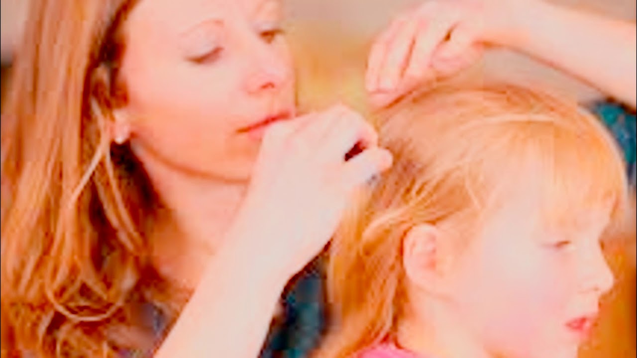 WOW ! How To Get Rid Of Nits In 4 Simple Steps And Fast - YouTube