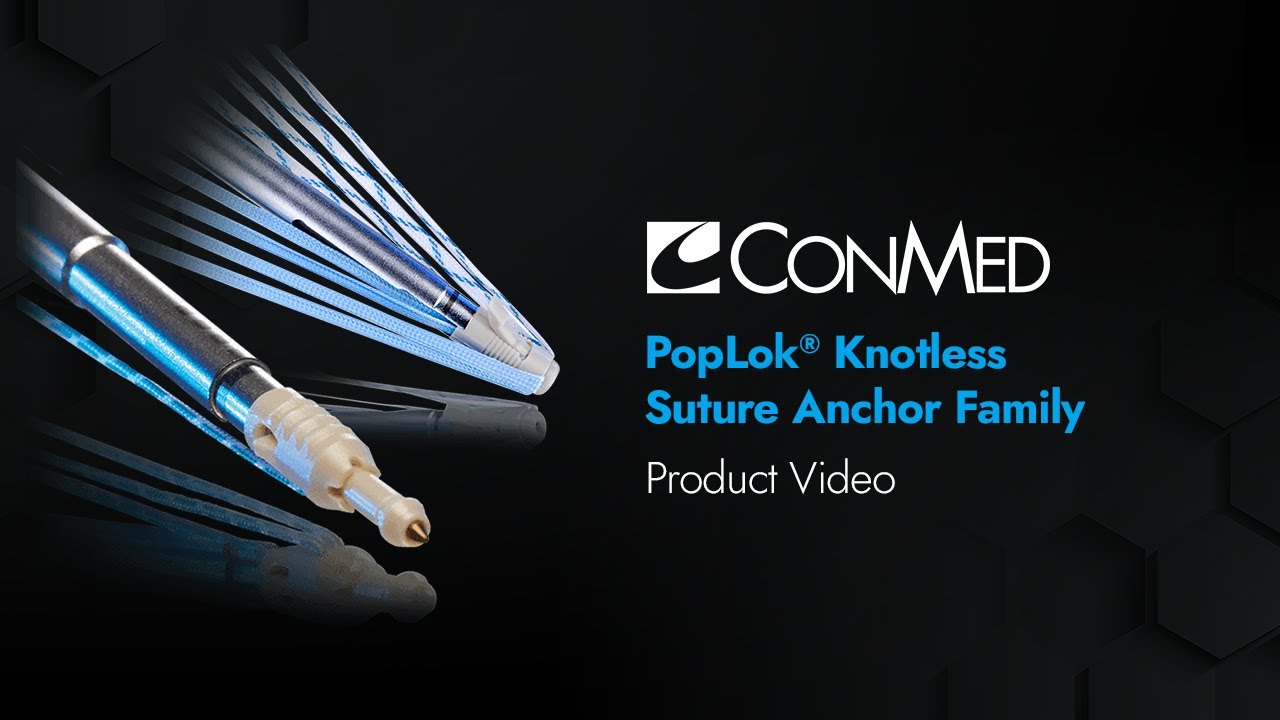 PopLok® Knotless Suture Anchor - ConMed Product Video - YouTube