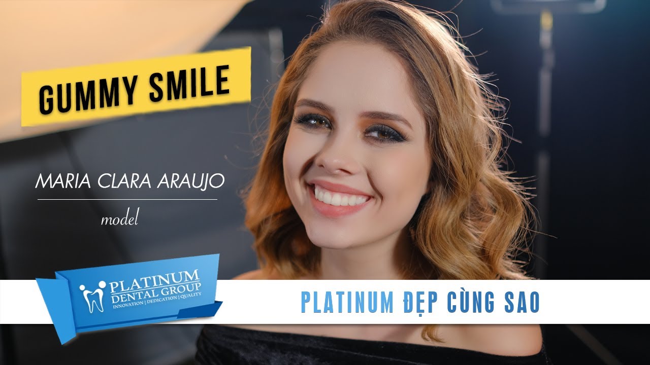 Model Maria Clara | Gummy Smile - Cười hở nướu | Platinum Dental Group ...