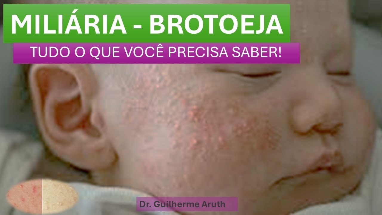 MILIÁRIA, BROTOEJA -, Tudo o que você precisa saber ! Ou SEMPRE quis ...