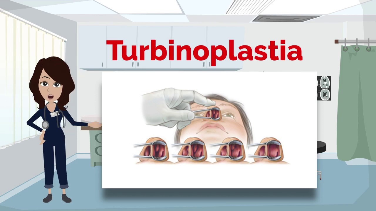 TURBINOPLASTIA - 10MO B - GRUPO 1 - YouTube