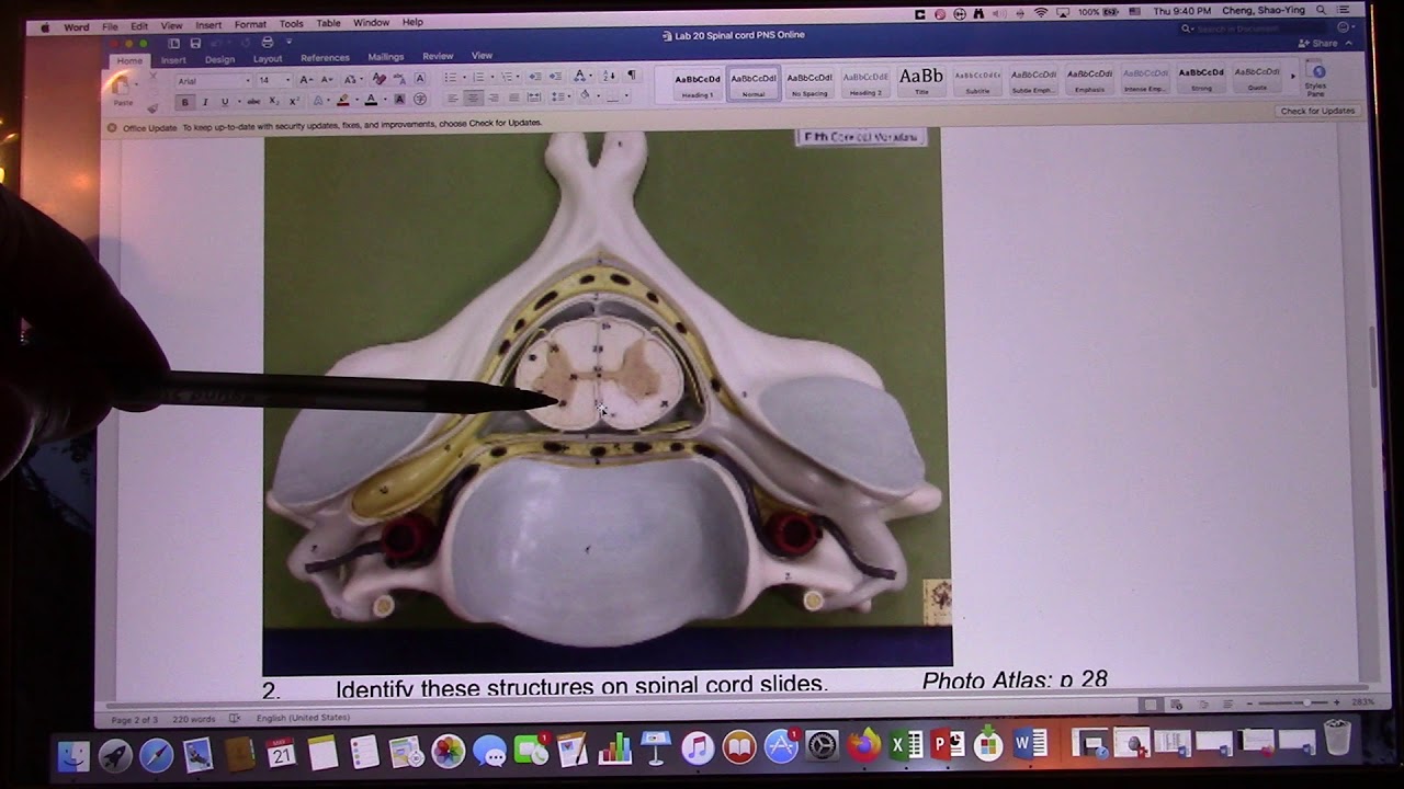 ACC Biol2401 API Lab19 Sheep Brain Dissection And Lab20 Spinal Cord acc-biol2401-api-lab19-sheep-brain-dissection-and-lab20-spinal-cord
