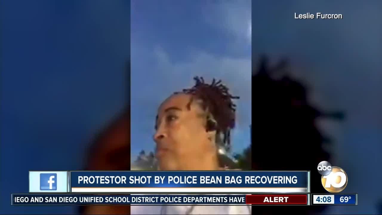 Protestor shot by police bean bag recovering - YouTube