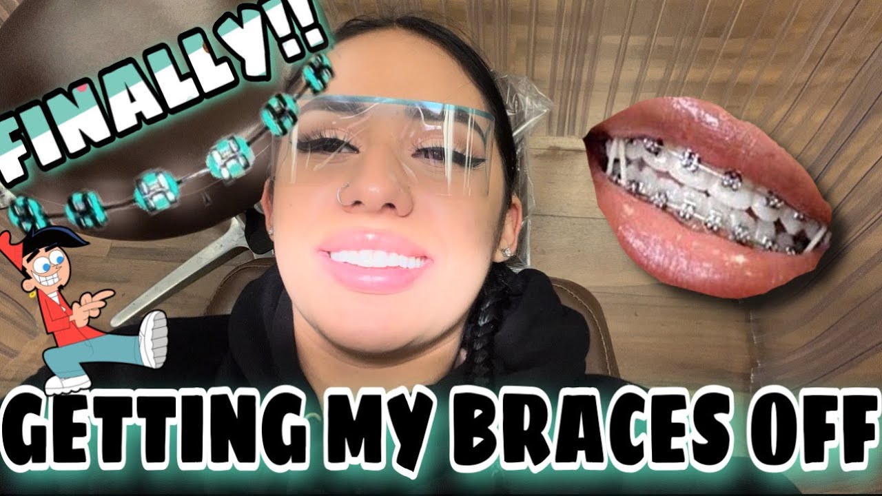 GETTING MY BRACES OFF! VLOG🧚 - YouTube