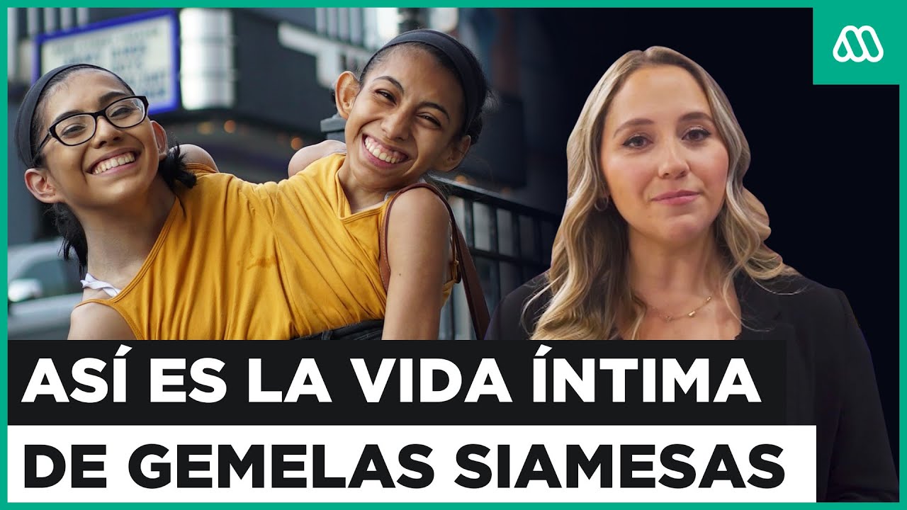 Así es la vida privada de gemelas siamesas: Cómo se coordinan para ...