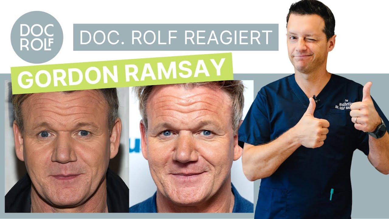 GORDON RAMSAY: Botox, Hyaluron oder doch "nur" Laser ?! doc.rolf ...