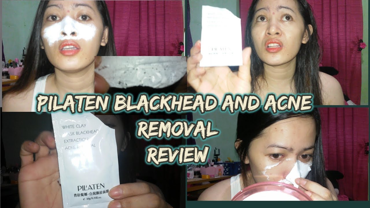 PILATEN BLACKHEADS AND ACNE REMOVER - YouTube