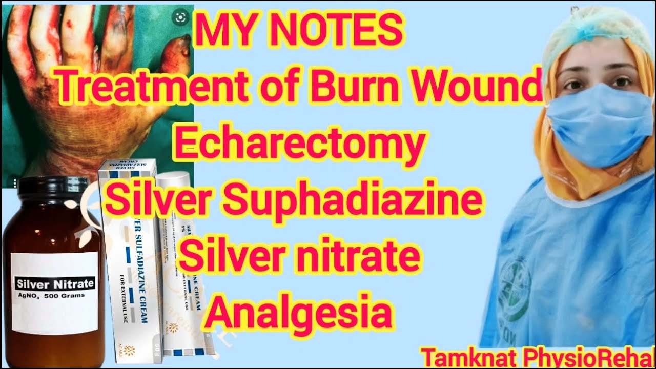 Burn wound Treatment Silver Suphadiazine Silver Nitrate Analgesia ...