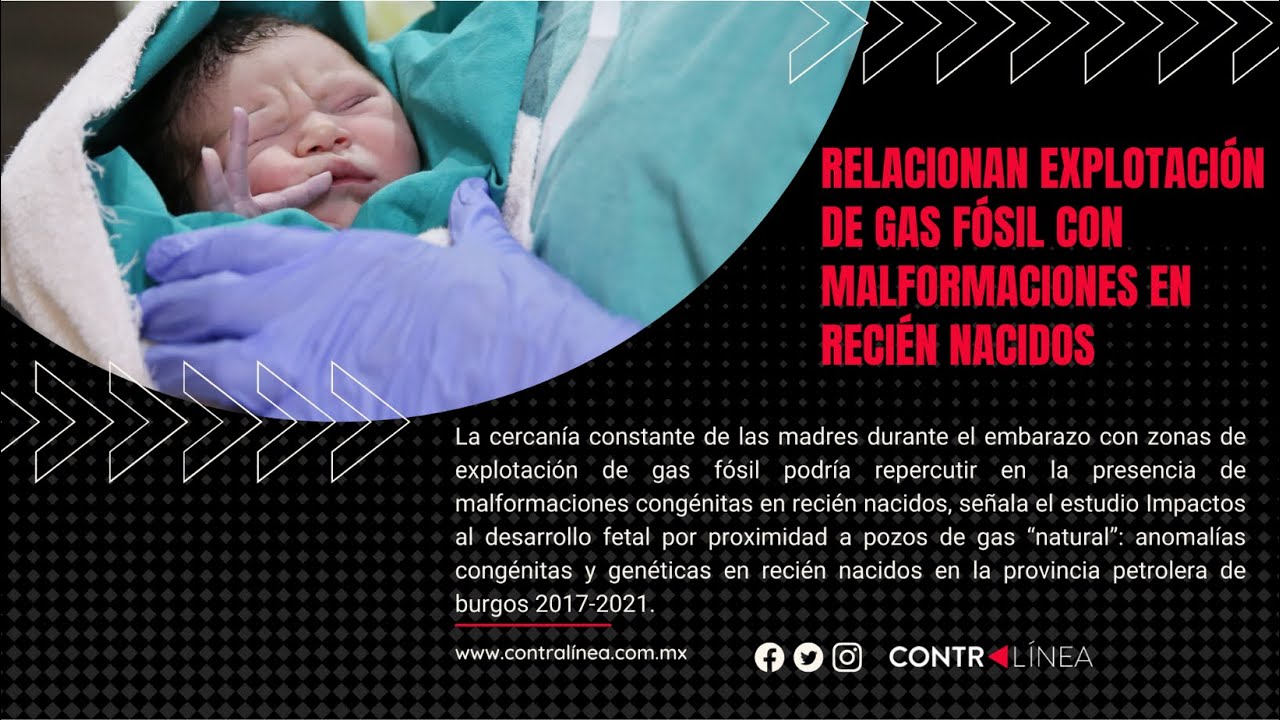 Malformaciones congénitas en recién nacidos: Los hallazgos son ...